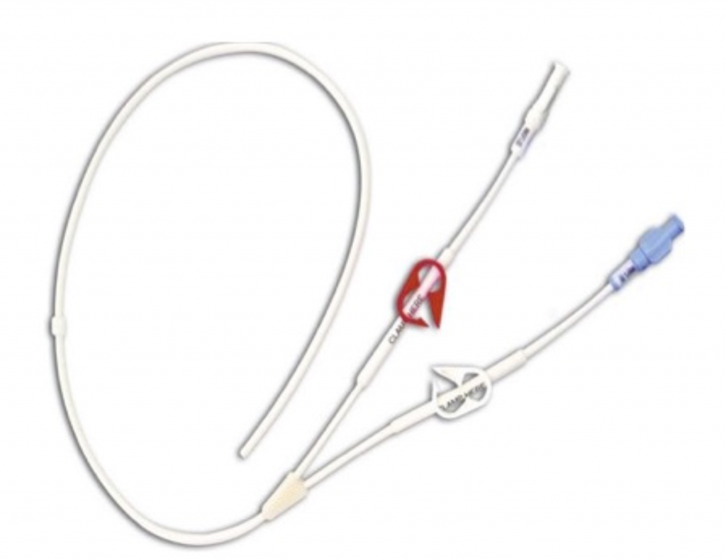 Cateter de Hickman - Hospital Nossa Senhora das Graças